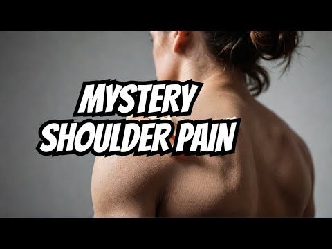 Os acromiale. (A rare cause of shoulder pain) - YouTube