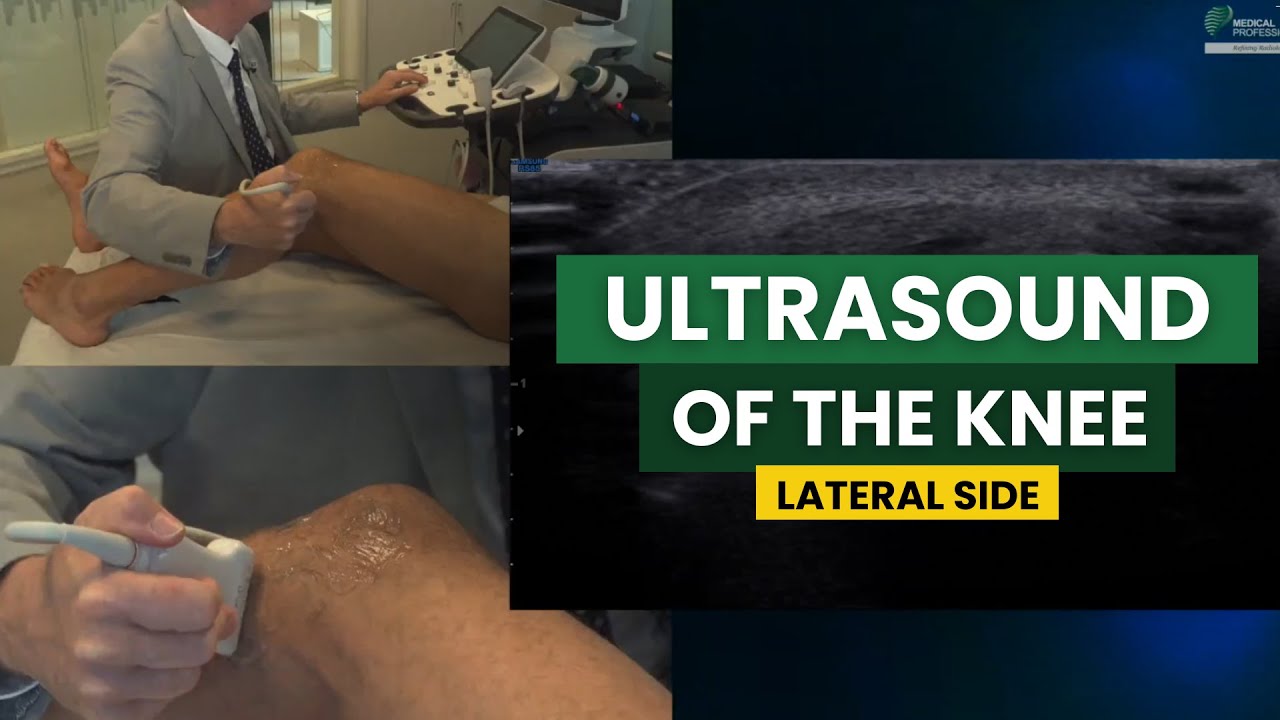 Ultrasound of the Knee: Anatomy & Pathology Explained - YouTube