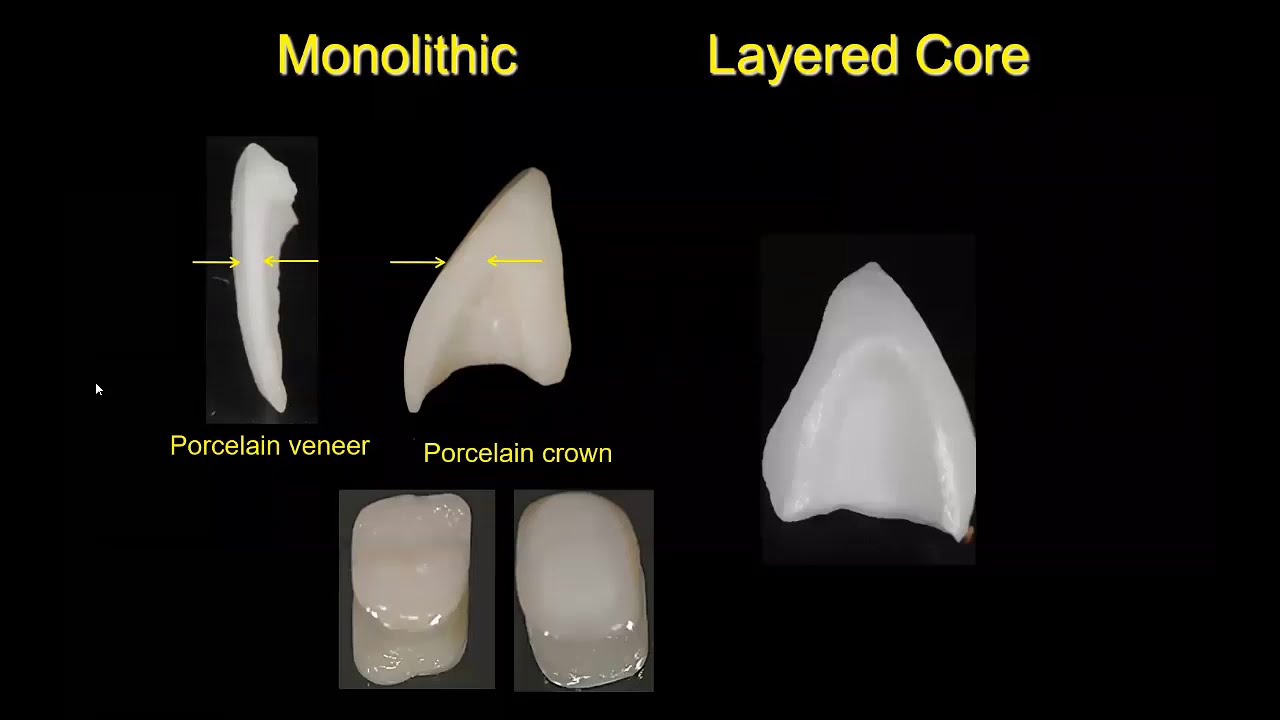 Dental Treatment: MAC Dentistry Dec 3, 2020 - YouTube