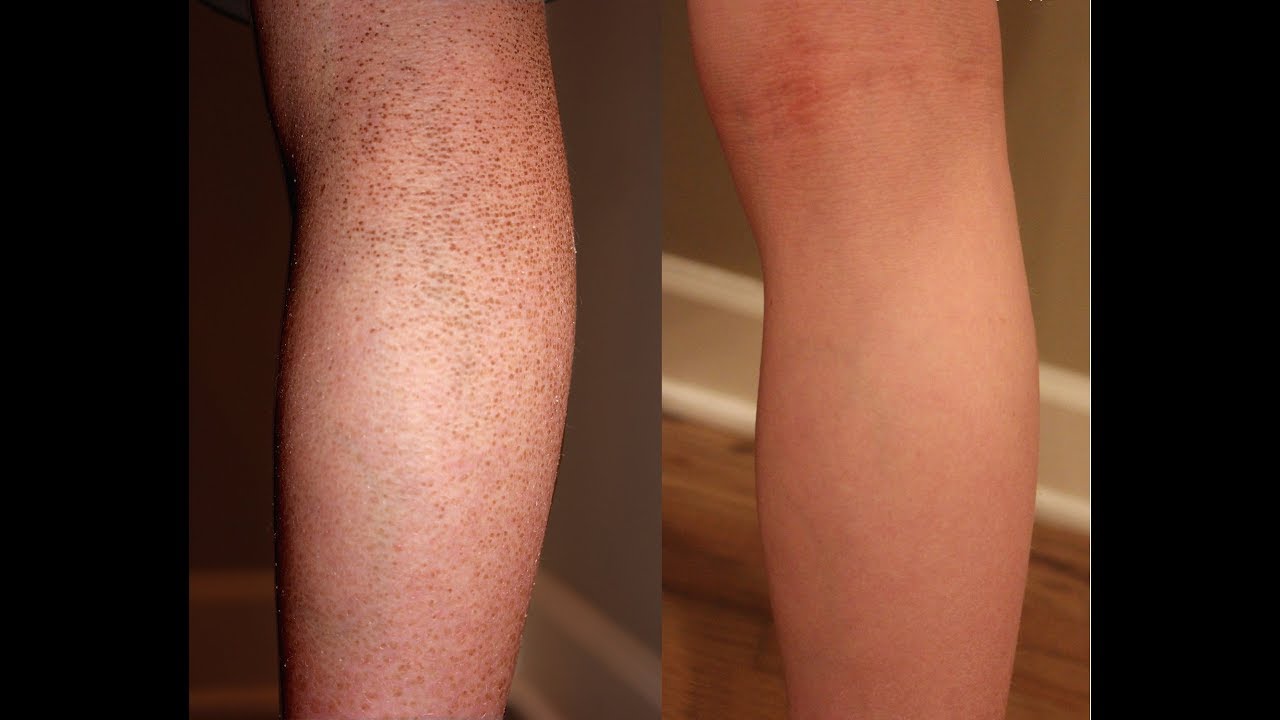 How to treat and cure Dry Skin with G16 Skin Repair - YouTube