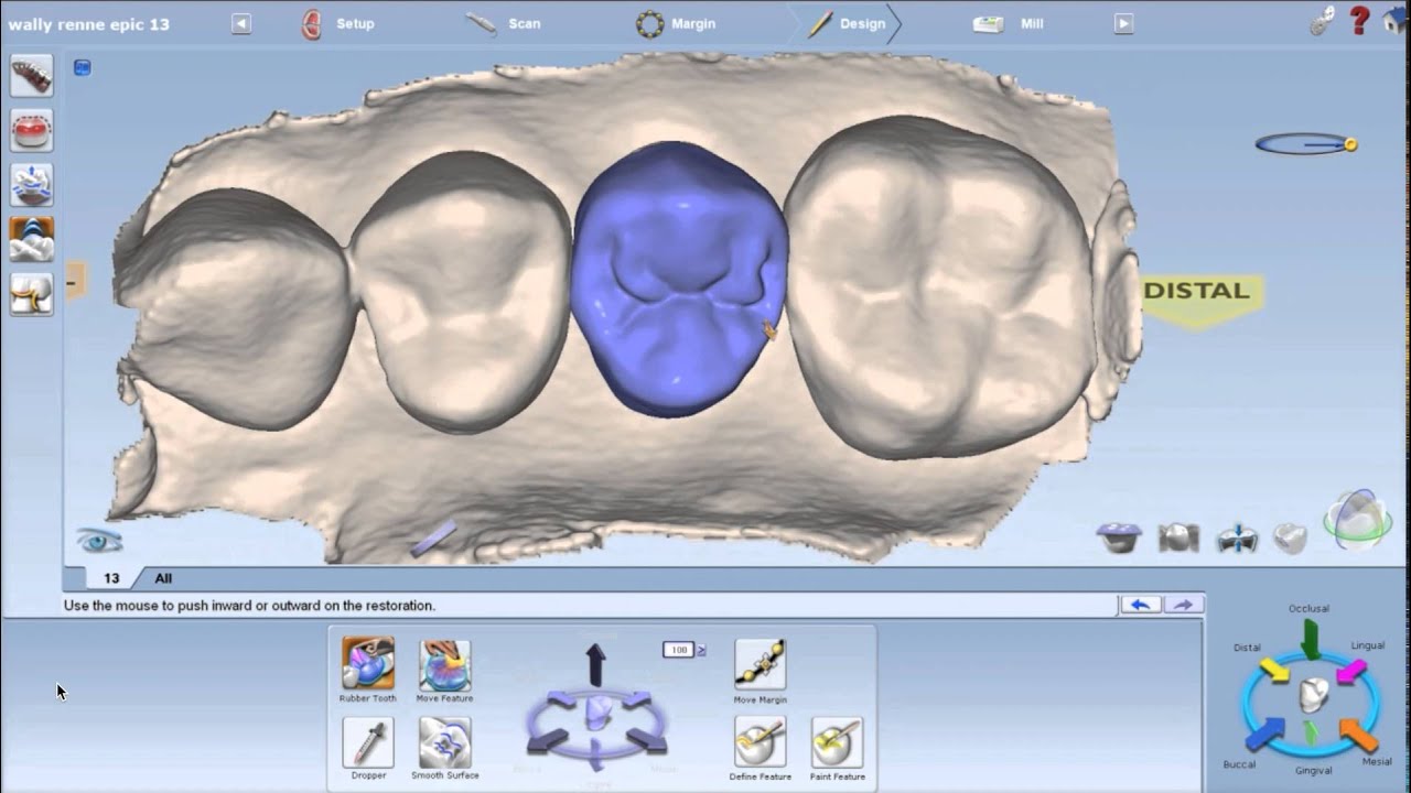 Planscan Crownlay tutorial - YouTube