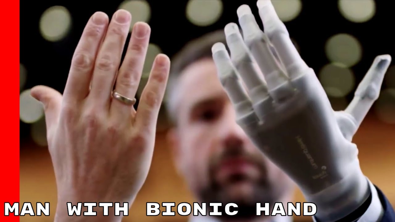 Man With Bionic Hand - YouTube