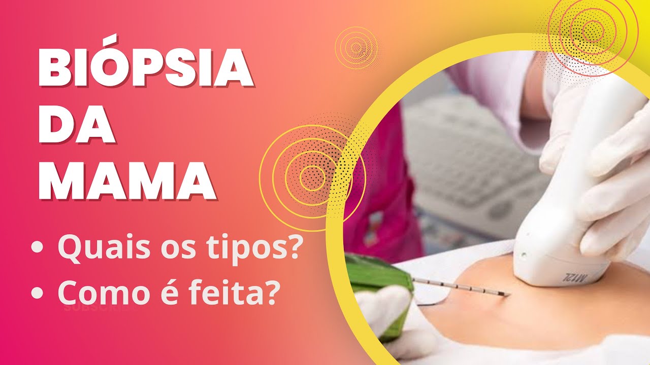 Biópsia da mama: quais os tipos? Como é feita? - YouTube