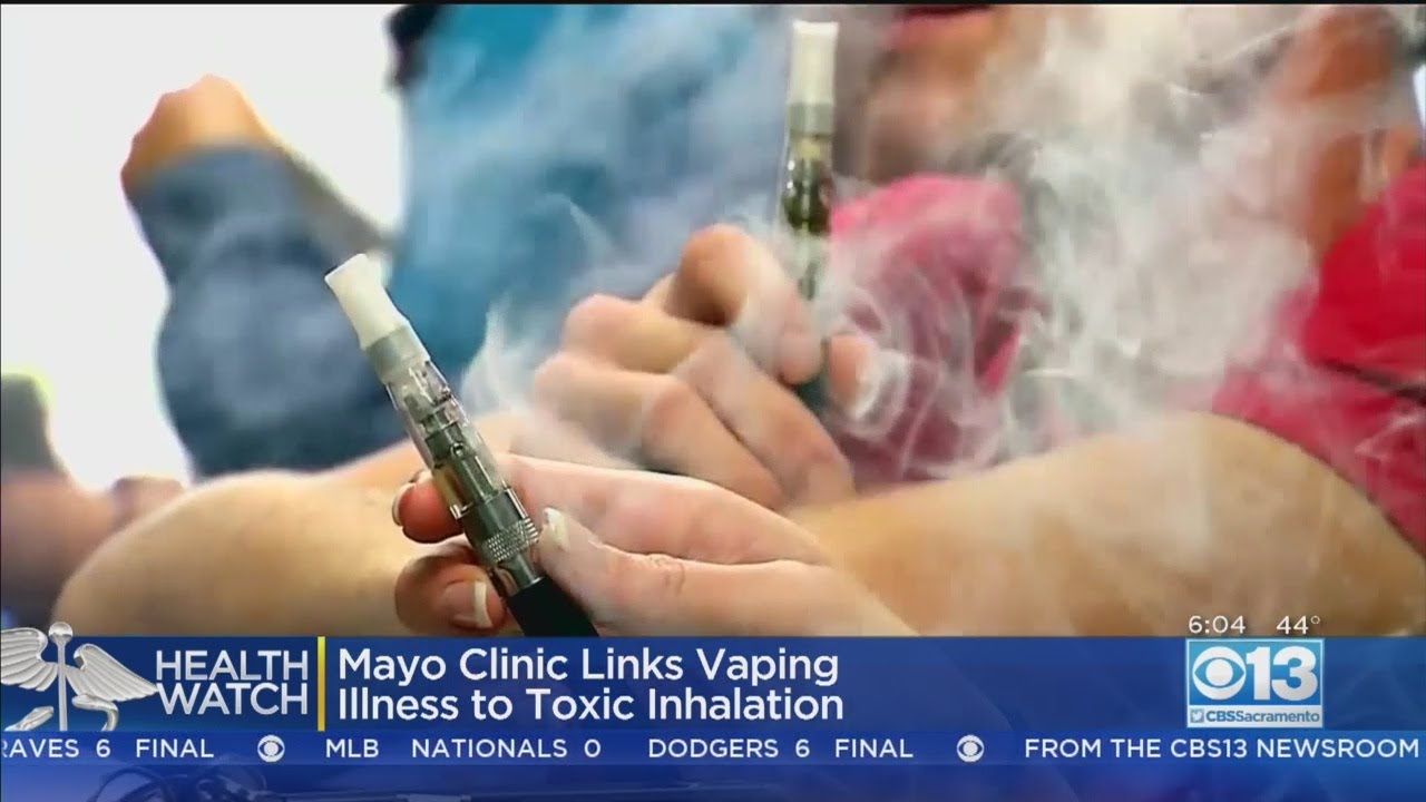 Vaping-Related Lung Injuries Resemble Chemical Burns, Mayo Clinc Says ...