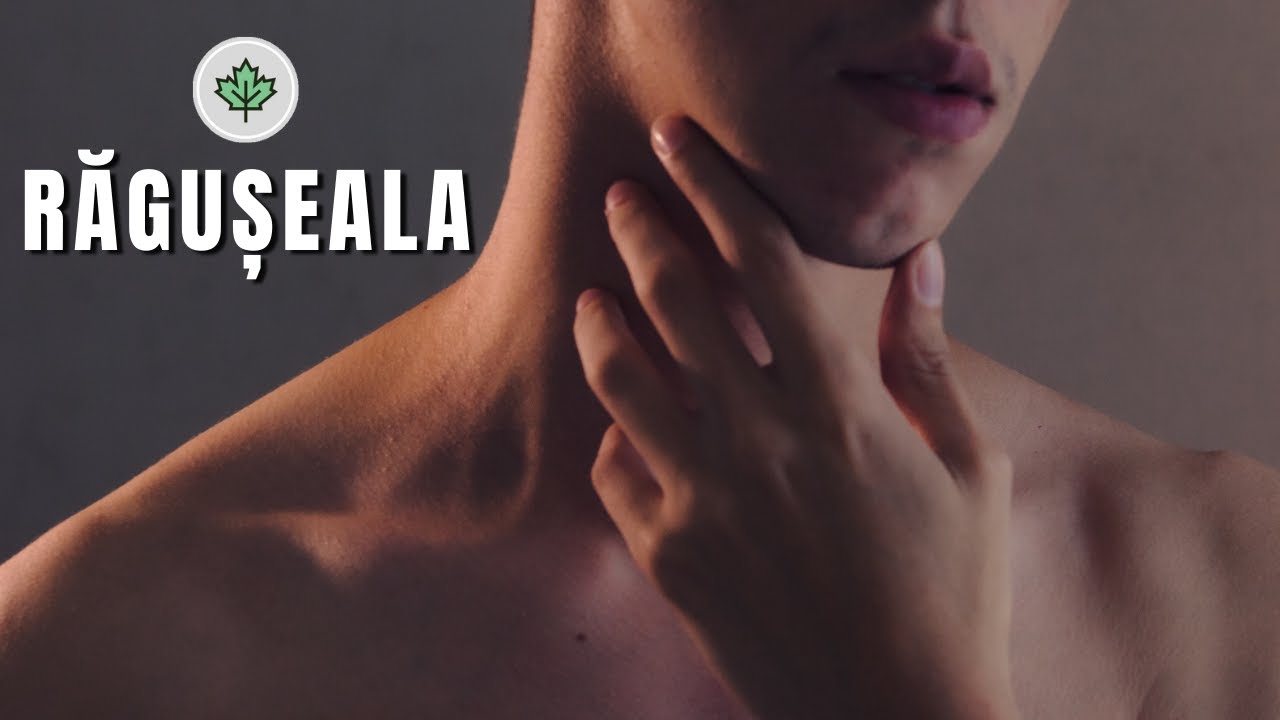 Scapa de raguseala cu ajutorul plantelor - YouTube