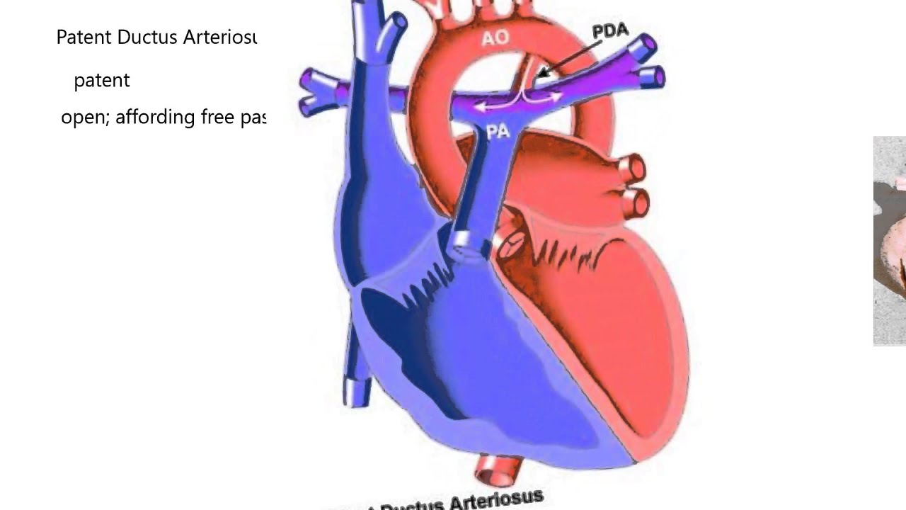 Heart4-Disorders in Pets - YouTube