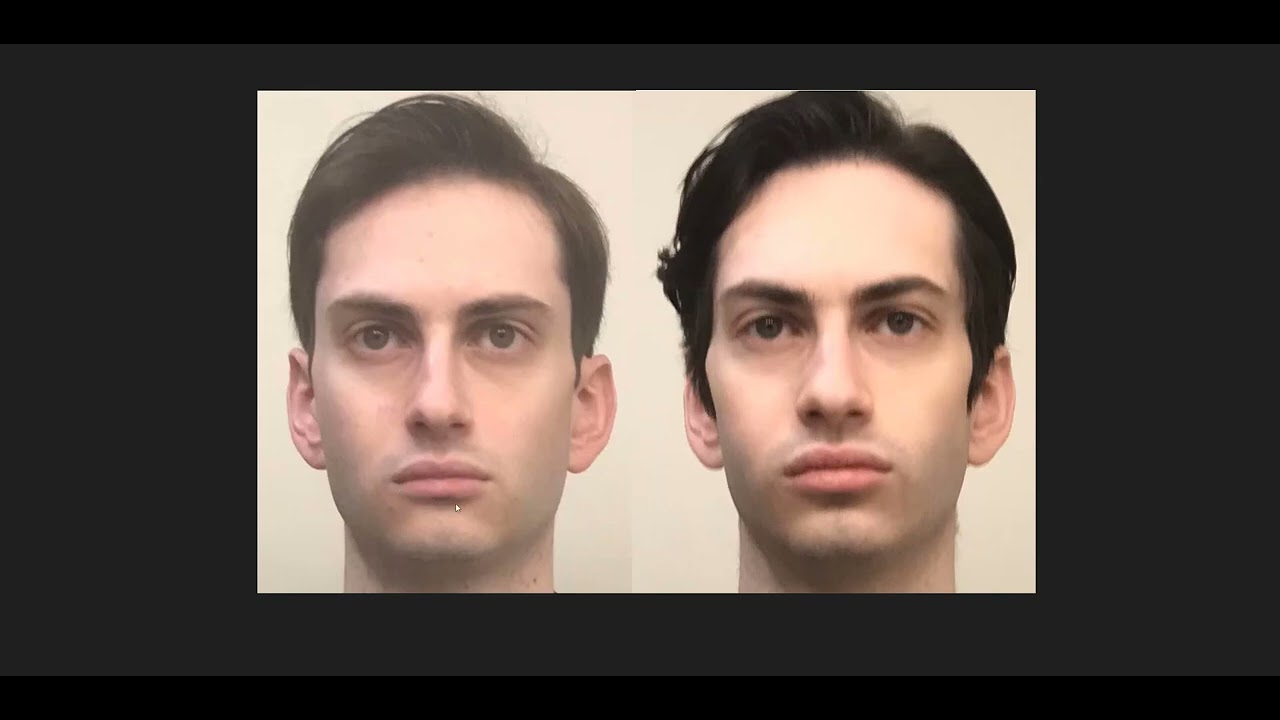 MSE and Facemask results after ~2 months - YouTube