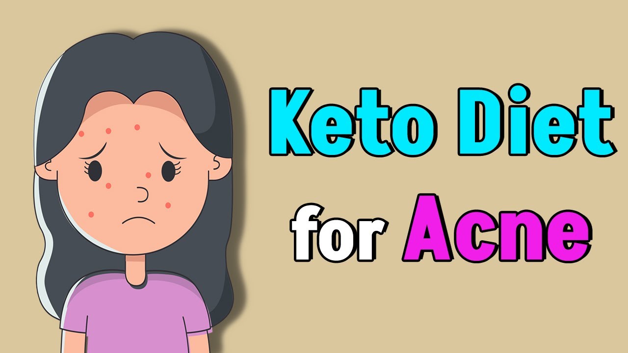 Keto Diet for Acne - YouTube
