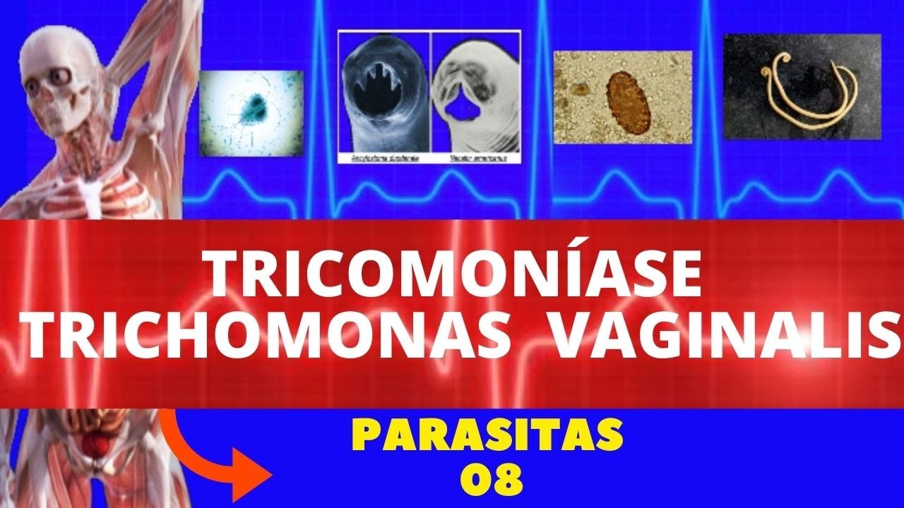 TRICOMONÍASE - TRICHOMONAS VAGINALIS| CARACTERÍSTICAS GERAIS -SINTOMAS ...