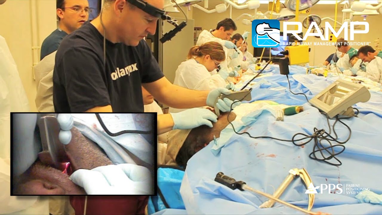 Airwaycam views pre/post ramping with an early generation RAMP ...