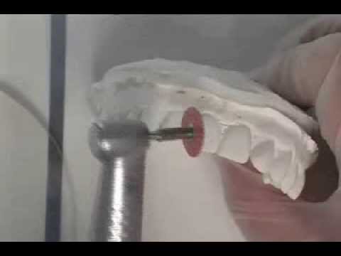 why Dentists polish Teeth - Polishing Instruments - YouTube