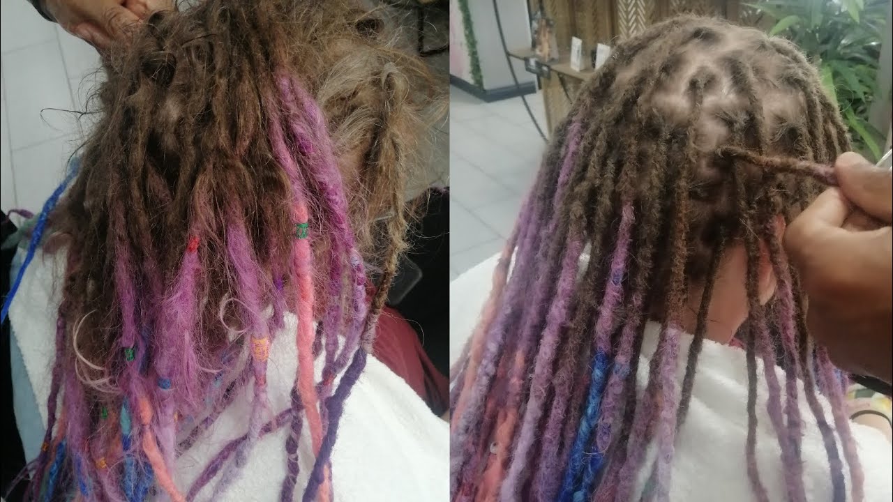 Check How We Fixed A Caucasian Dreadlocks Growth ...