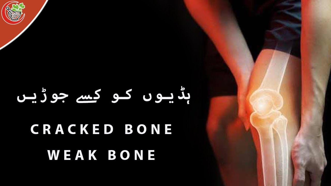 WEAK & CRACKED BONE TREATMENT BY HAKEEM ABBAS ALI - YouTube