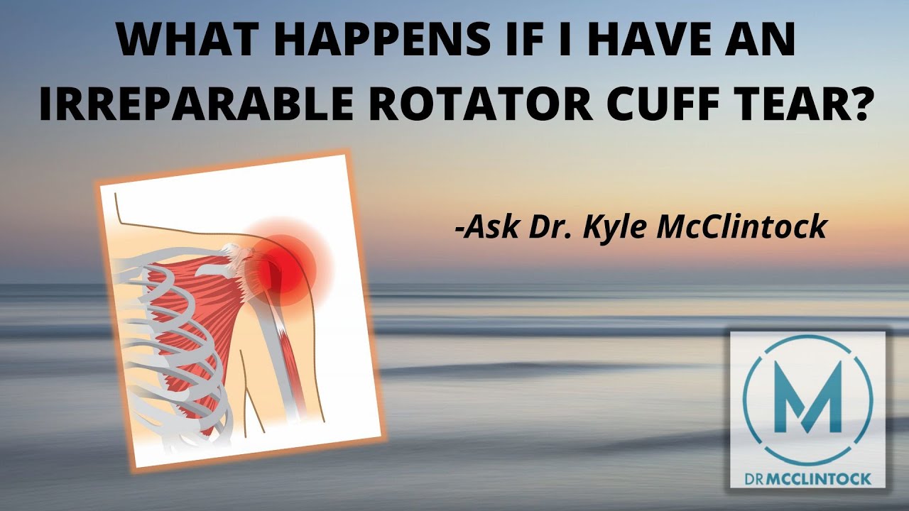 What Happens if I Have an Irreparable Rotator Cuff Tear? | Dr. Kyle ...