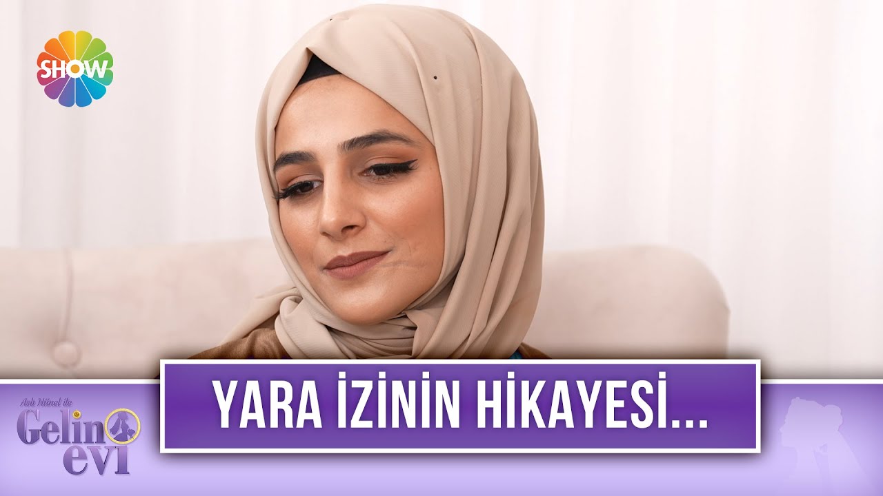 Beyza Nur gelinin yüzündeki yaranın hikayesi... | Gelin Evi 950. Bölüm - YouTube