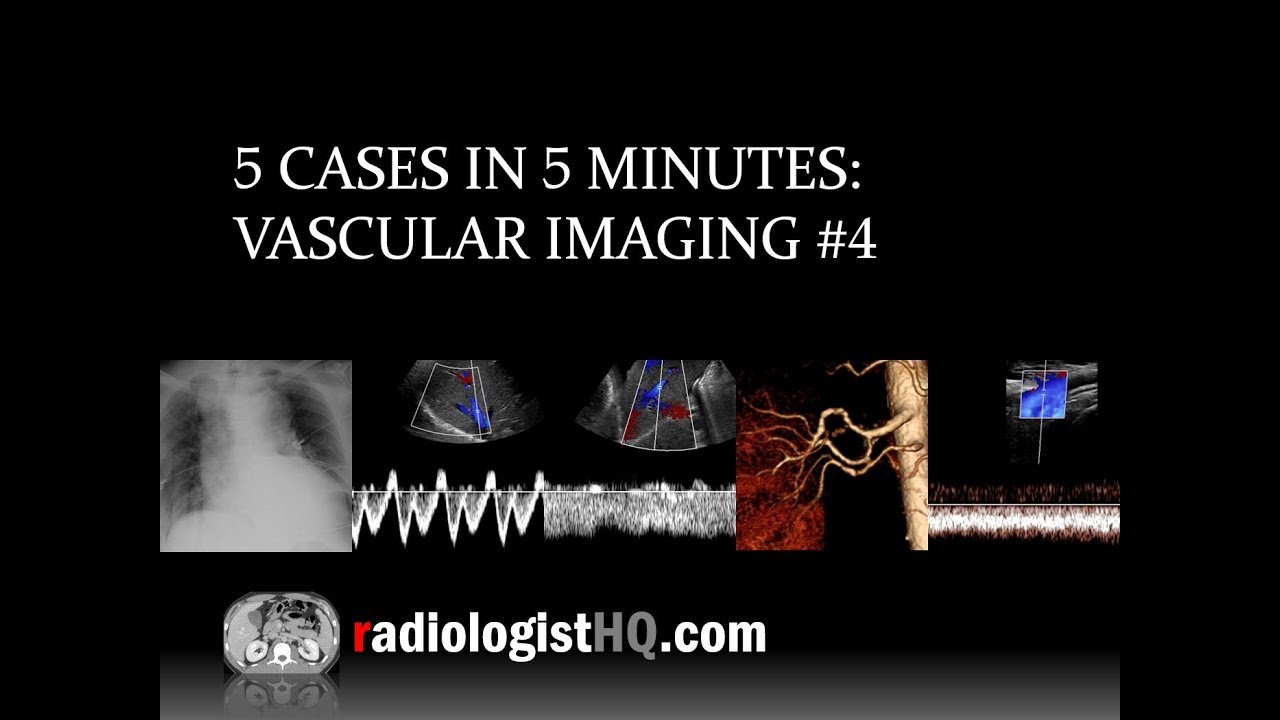 5 Cases in 5 Minutes: Vascular #4 - YouTube