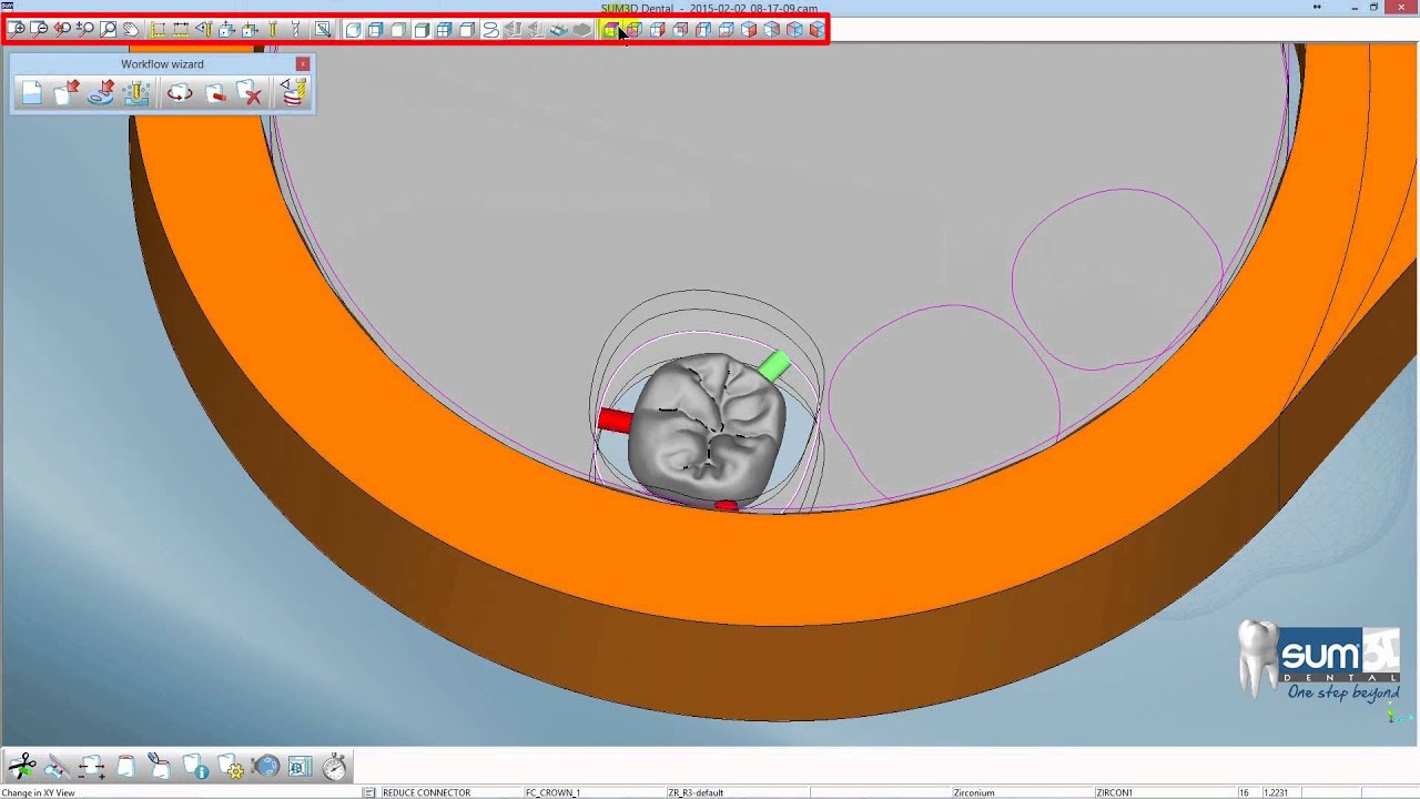 SUM3D Dental - User Interface Basics - YouTube