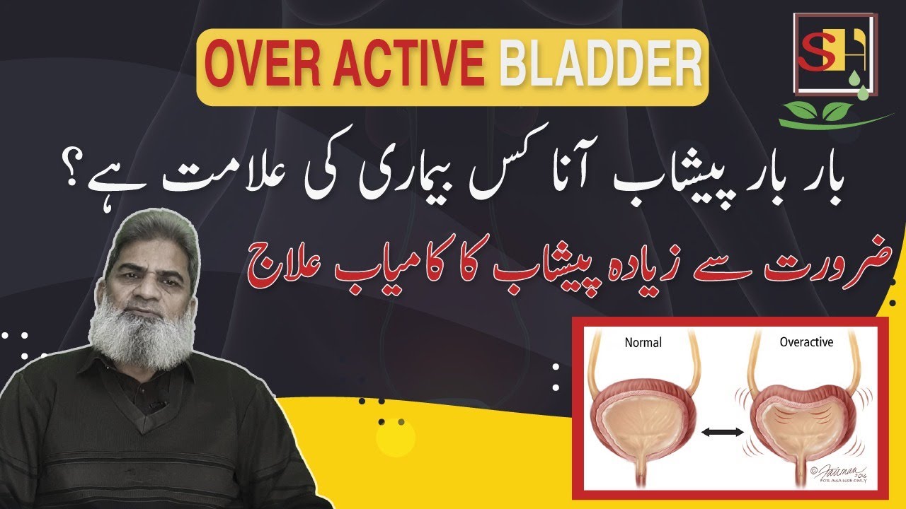 Overactive bladder||kidney||Bladder problems|| Bladder incontinence ...