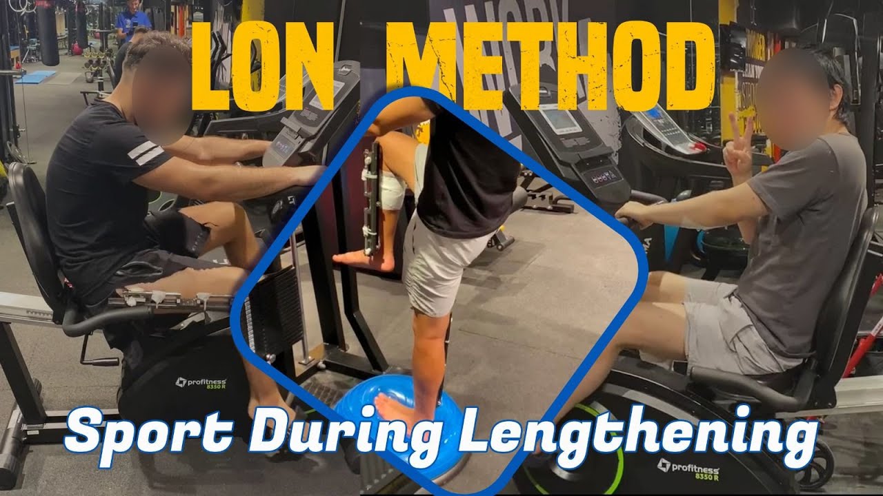 Can I do Sport/ fitness during the limb lengthening progress with the ...