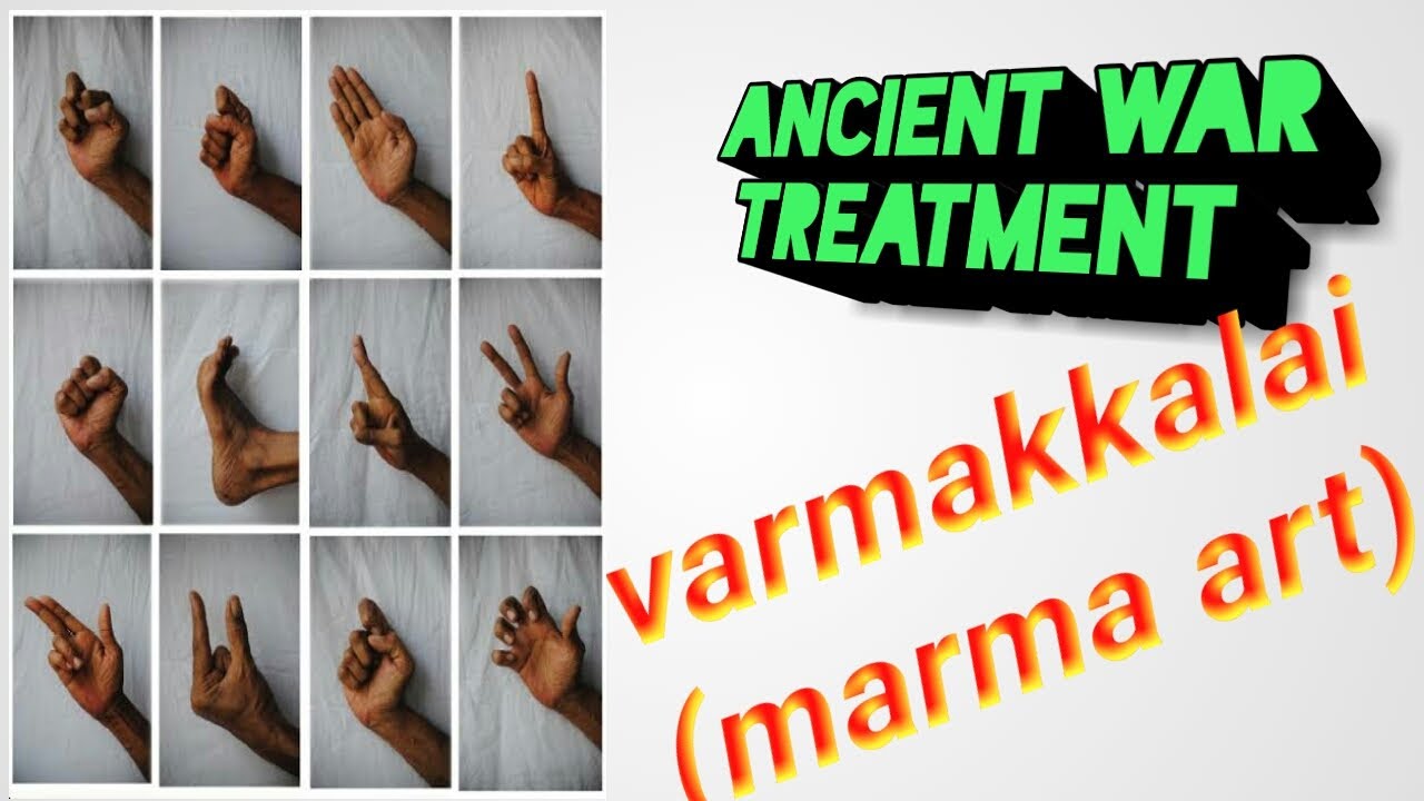 (V119- english ) Marma treatment (varmakkalai)// మర్మ చికిత్స - YouTube
