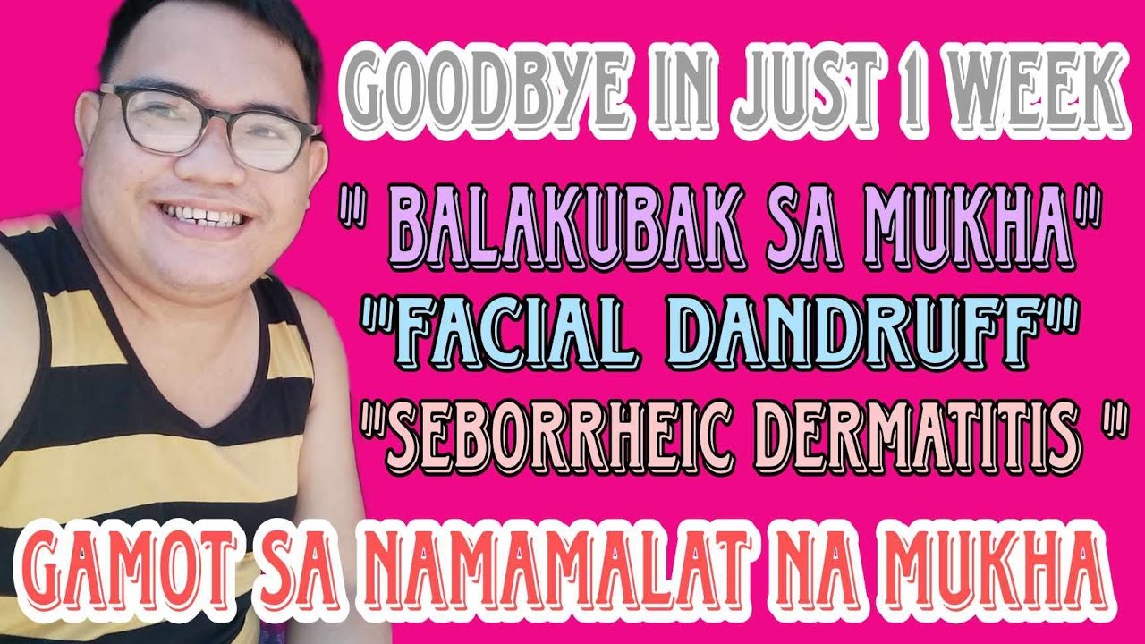 Namamalat Na Mukha | Balakubak sa Mukha | Seborrheic Dermatitis ...