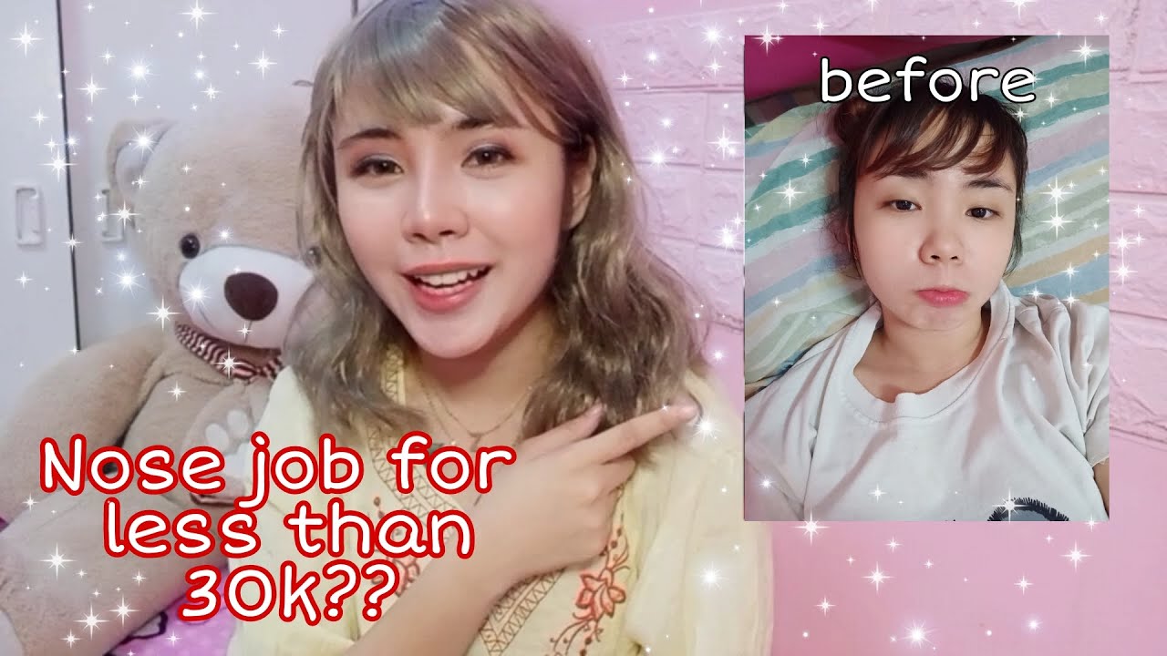MY RHINOPLASTY JOURNEY| Nose job for less than 35k? - YouTube