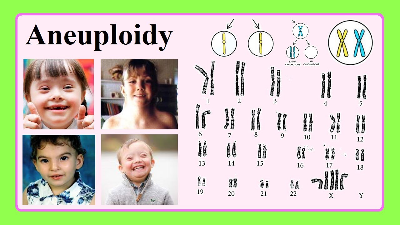 aneuploidy - YouTube