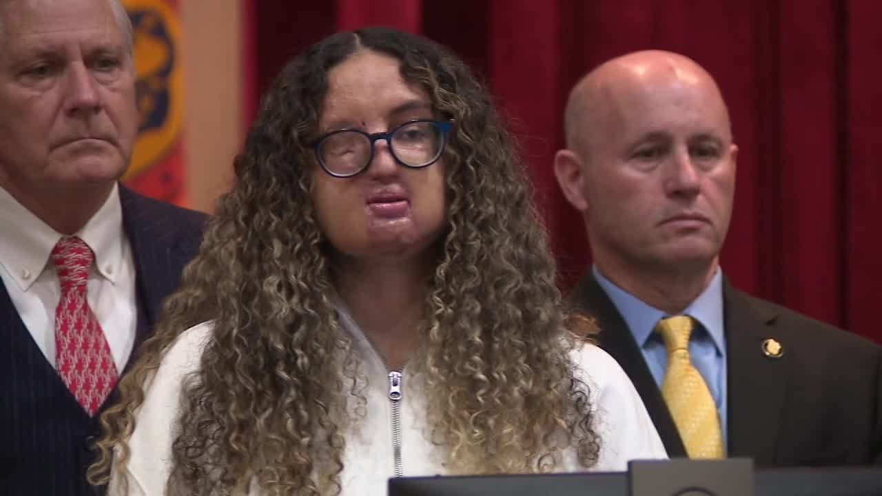 Acid attack victim updates her condition - YouTube