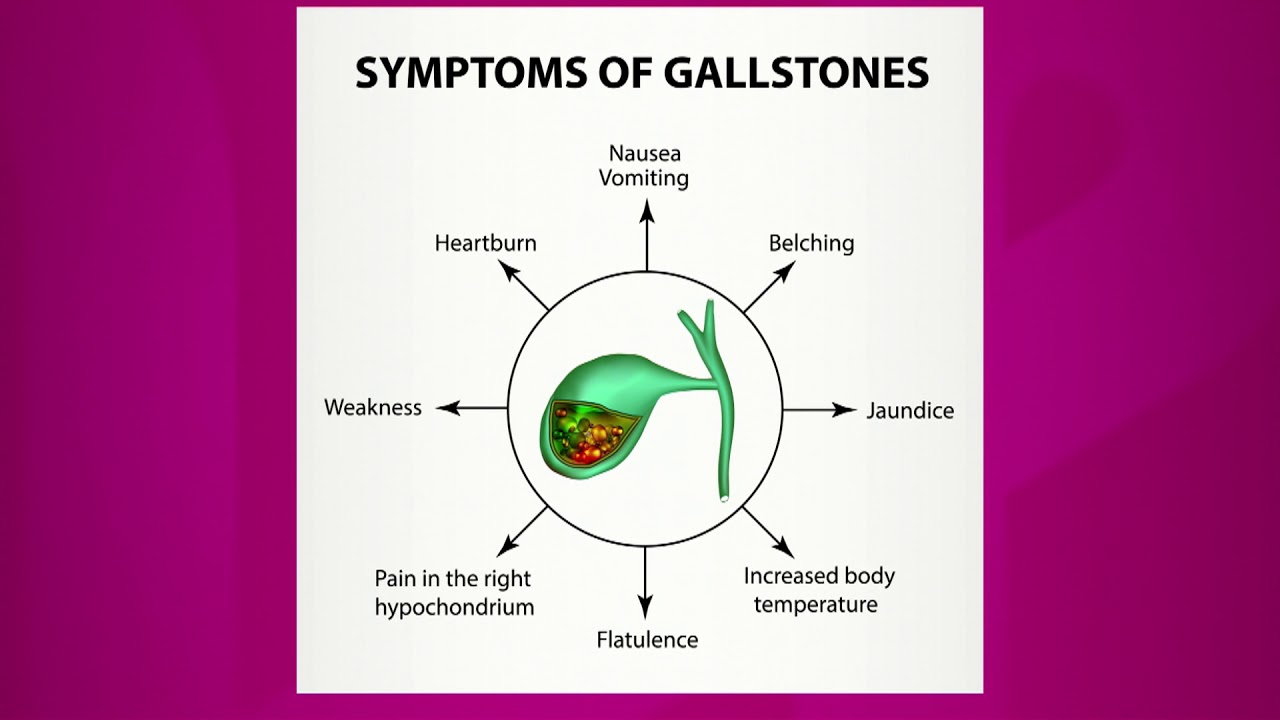 Symptoms Of Gallstones YouTube Symptoms Of Gallstones YouTube