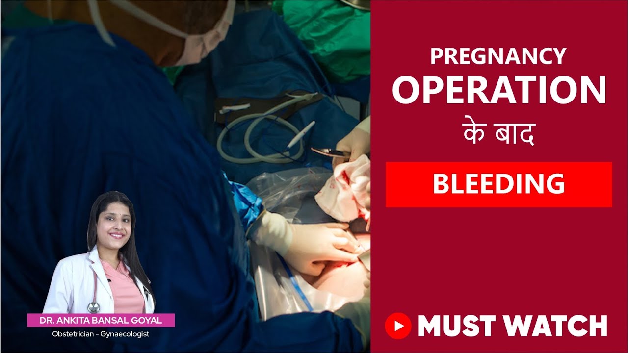 Bleeding After Pregnancy Operation | Dr. Ankita Bansal Goyal #shorts # ...