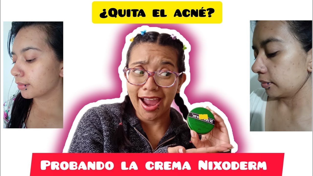 Probando la crema Nixoderm para el acné / Leidy Cepeda - YouTube