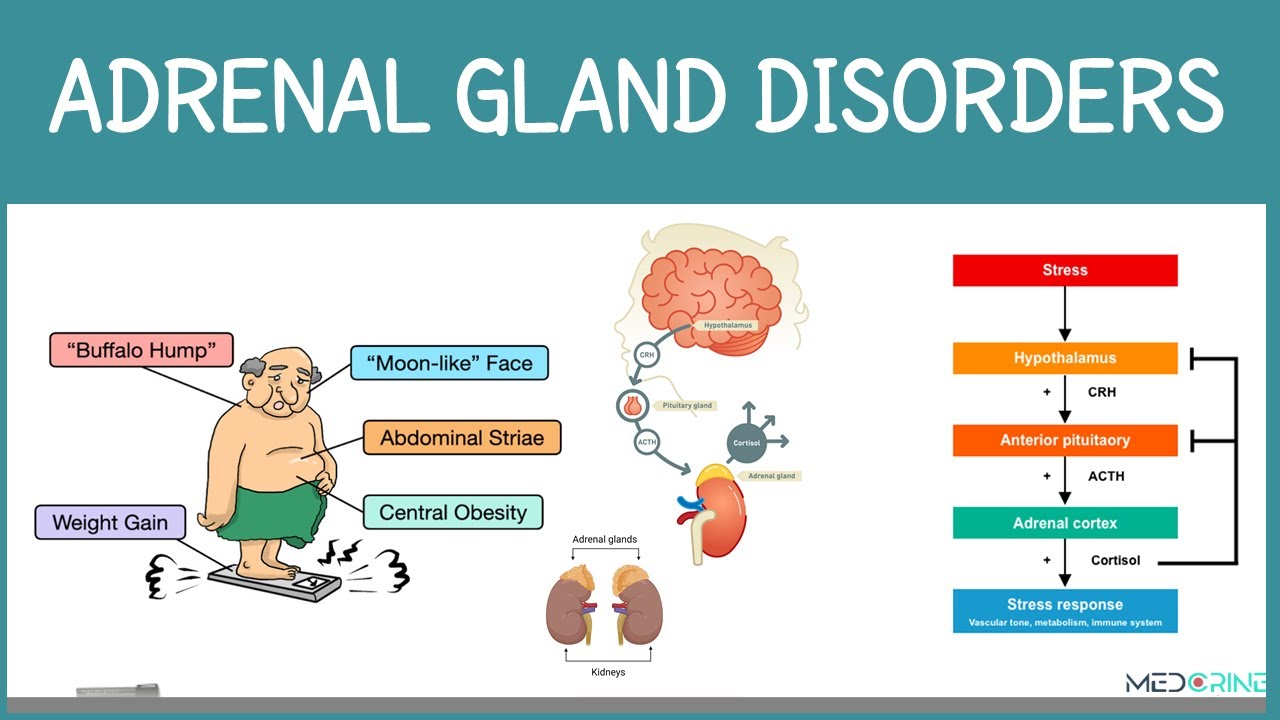 Adrenal Gland Disorders Explained | Addison’s Disease, Addisonian ...