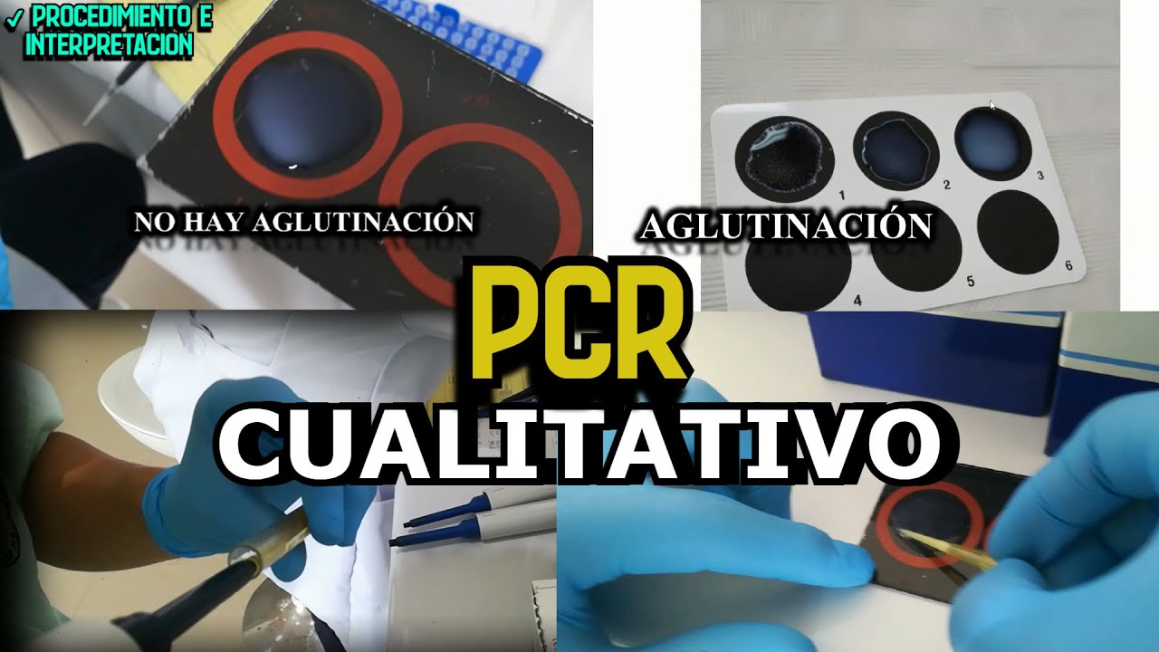 PCR Cualitativo en Placa: Procedimiento Explicado - YouTube
