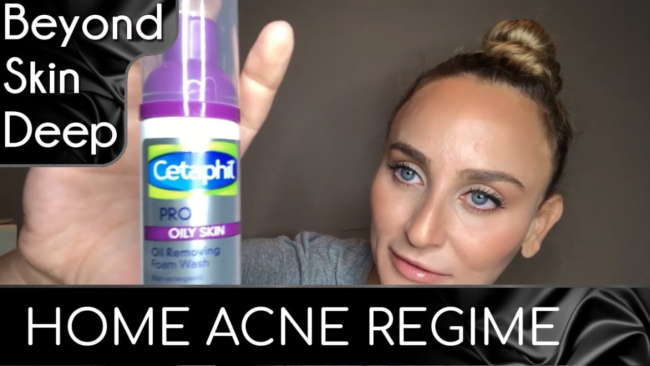 ACNE TREATMENT Simple Daily At Home Skincare Regimen (Acne Routines ...