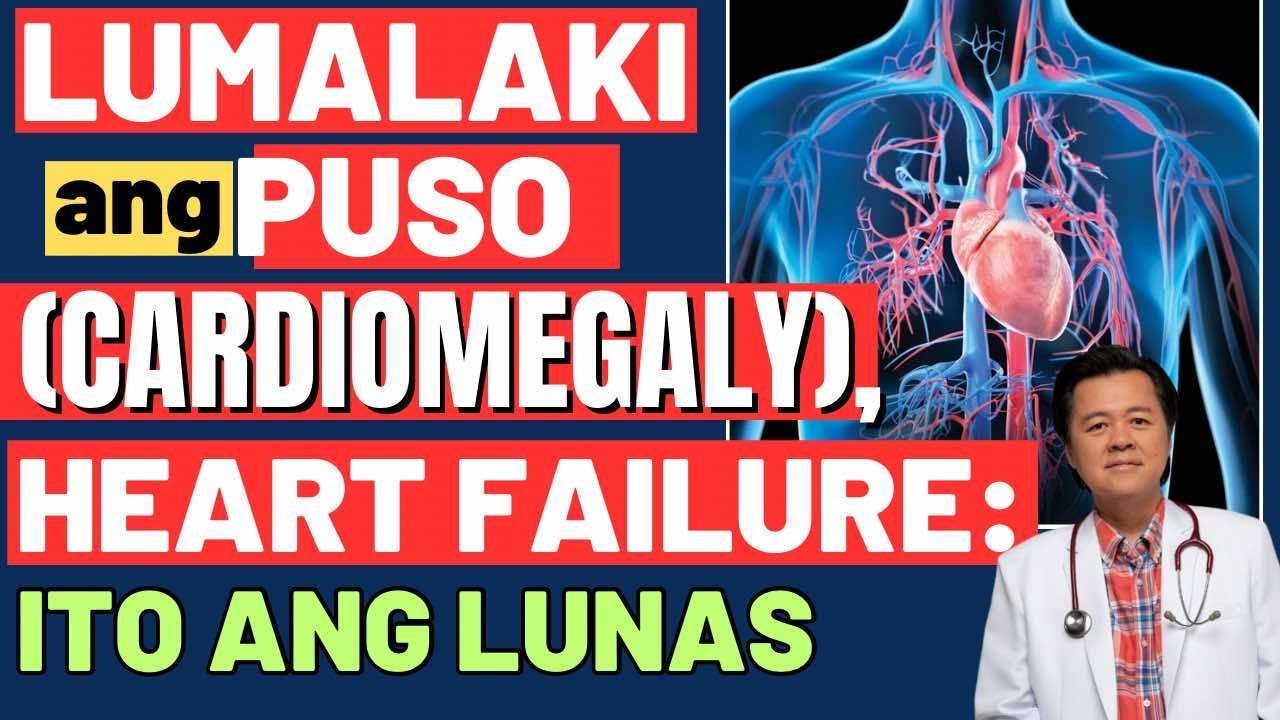 Lumalaki ang Puso (Cardiomegaly), Heart Failure: Ito ang Lunas. - By ...