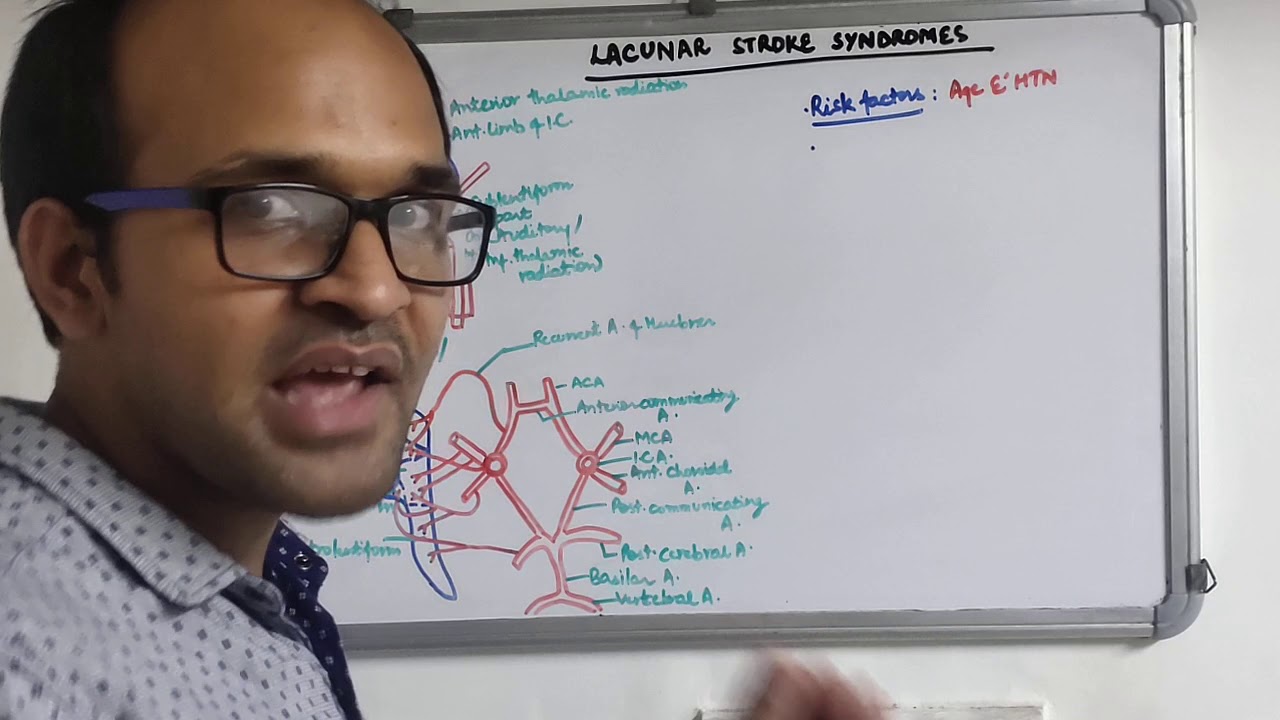 Lacunar strokes : Stroke localization part 4/4 - YouTube