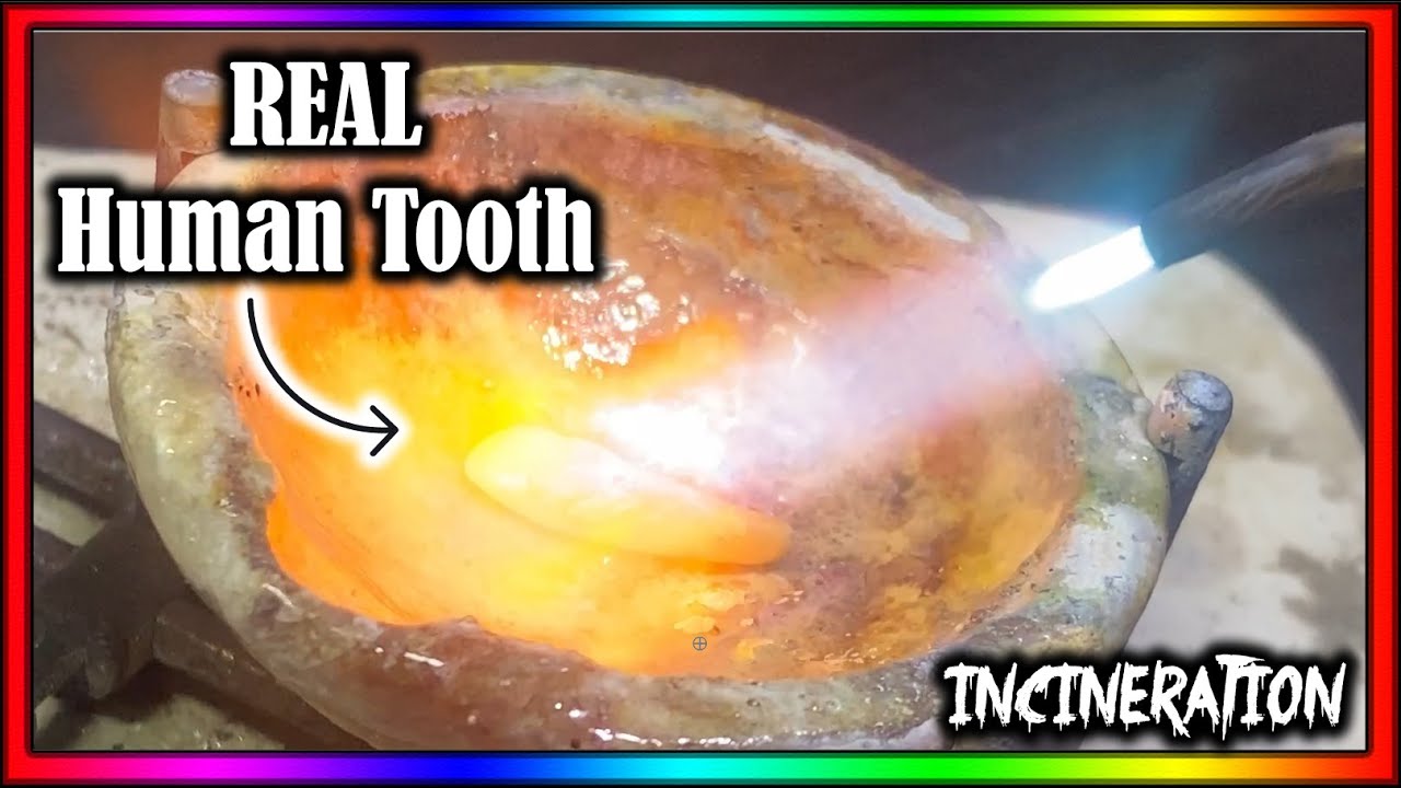 Cremation - What happens to Teeth (Warning - Explosions) - YouTube