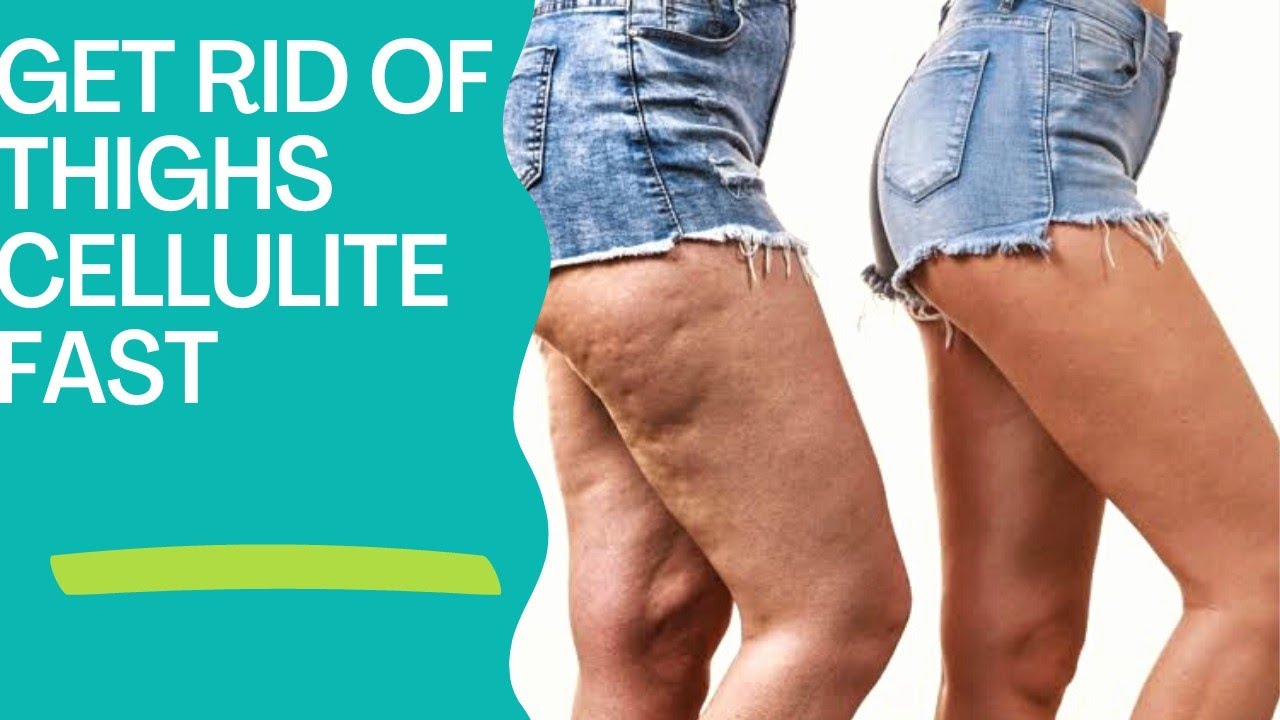 6 Exercises to Get Rid of Butt And Thighs Cellulite - YouTube