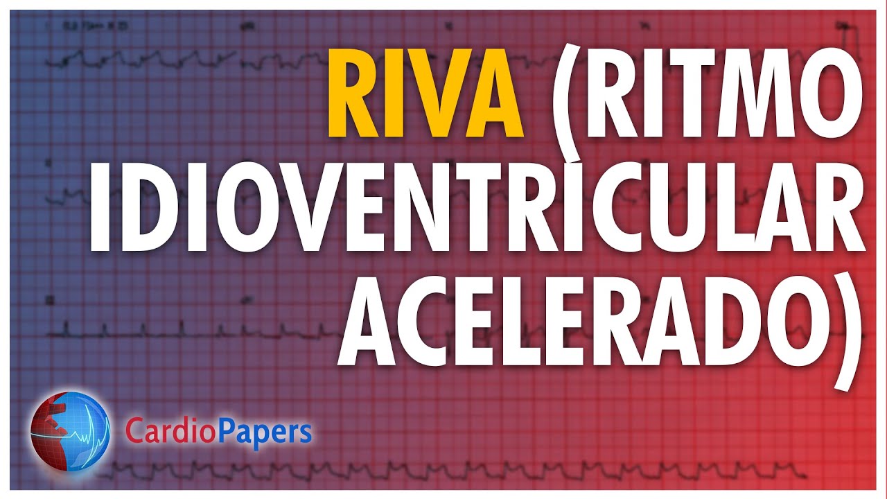RIVA (ritmo idioventricular acelerado) - YouTube