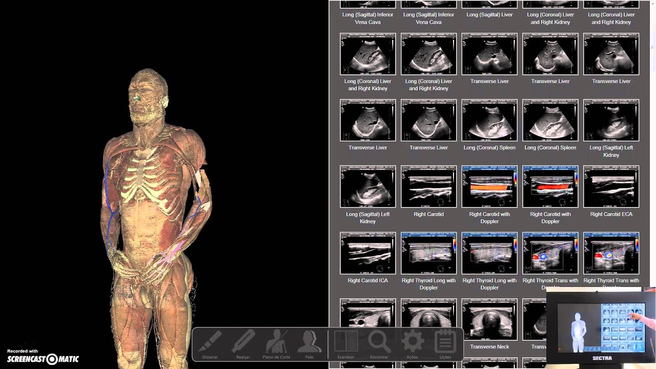 VH Dissector em Português - YouTube