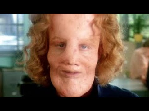 ROCKY DENNIS 1st Day New school - YouTube