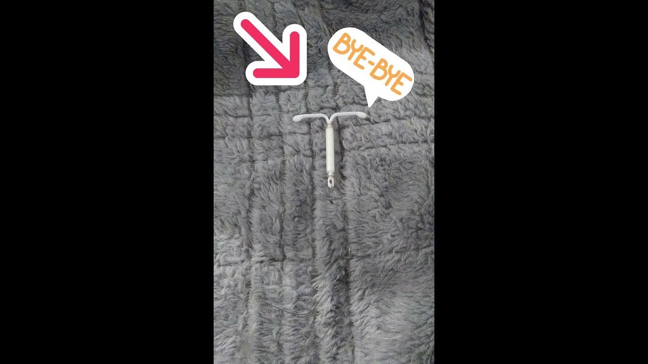IUD pain FREE home removal - YouTube
