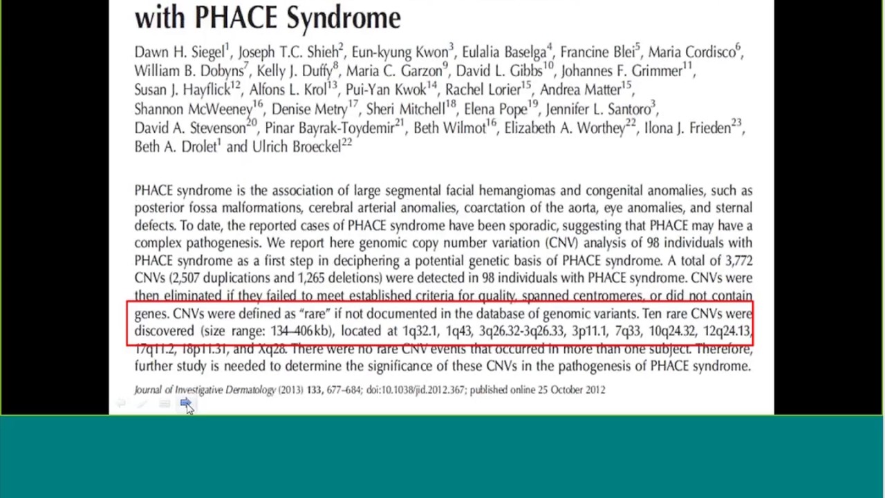 Investigations into the cause of PHACE Syndrome - YouTube