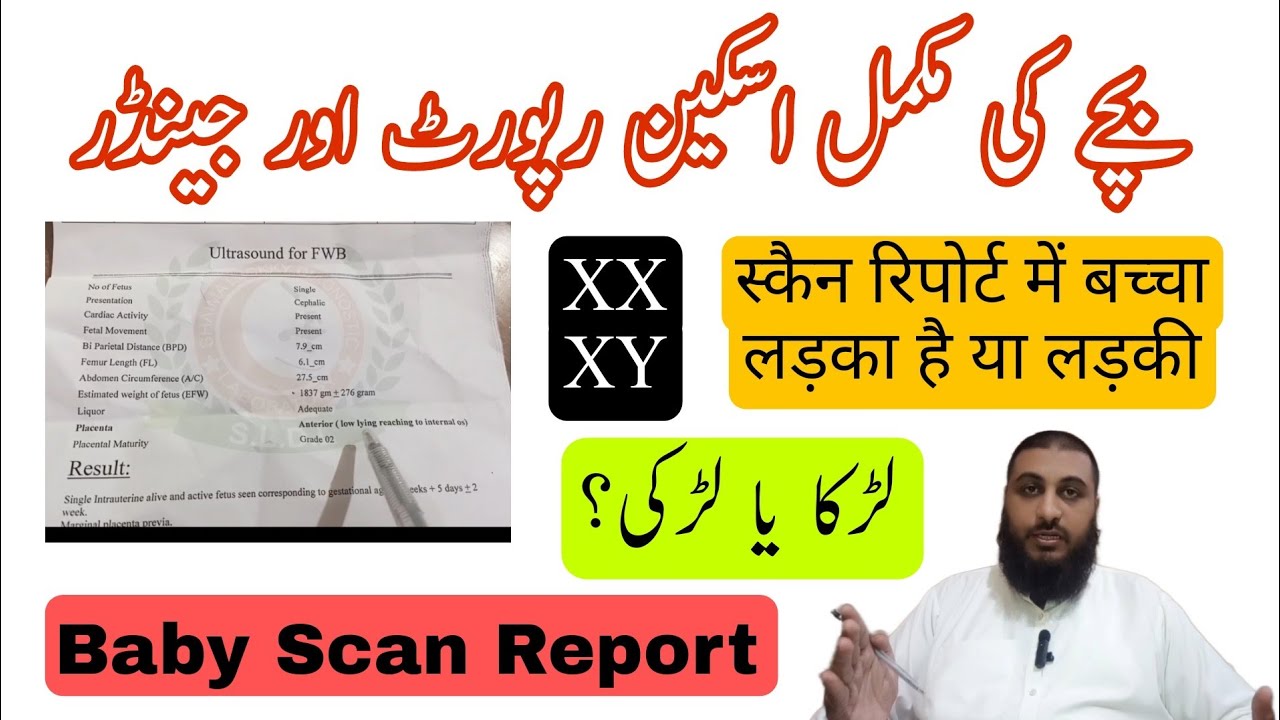 FWB report Gender reveal | ultrasound gender report | baby scan report ...