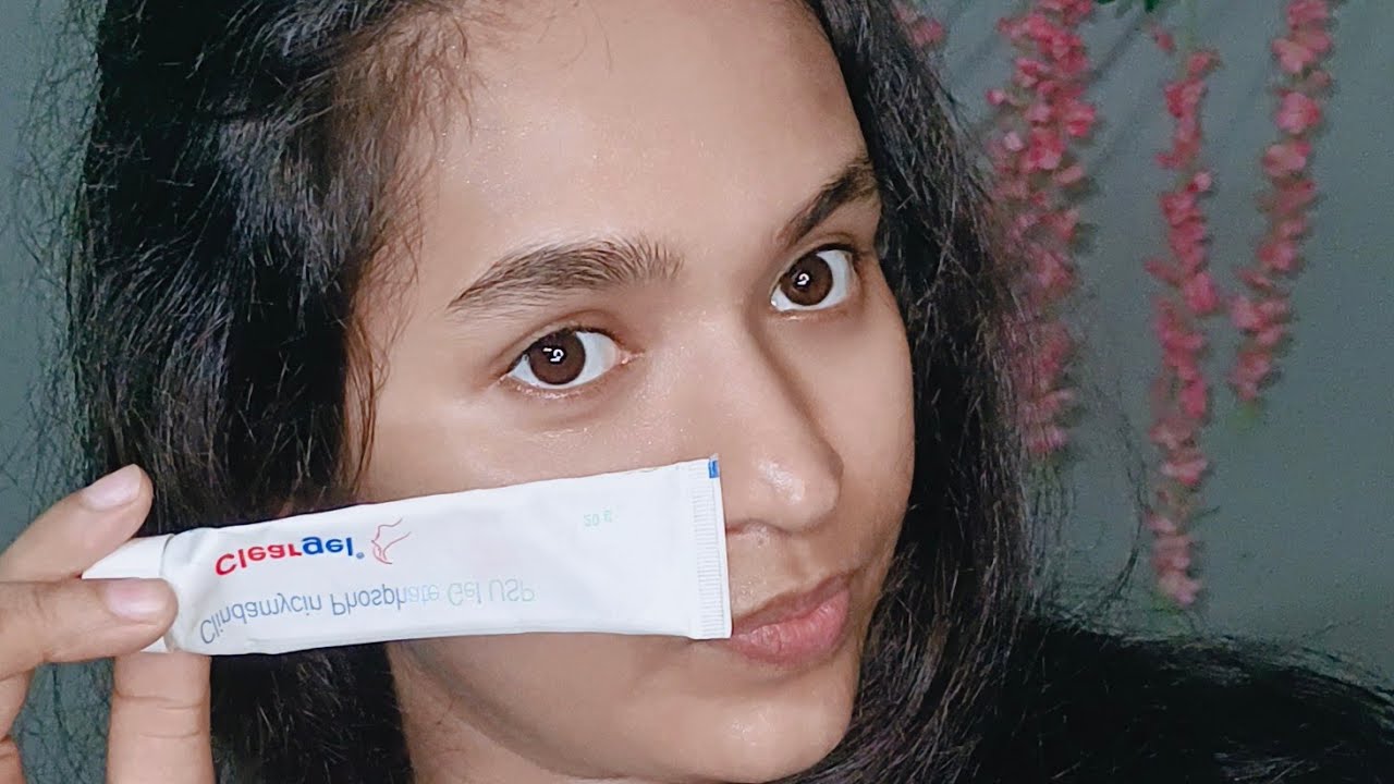 Clear Gel How To Use | Clear Gel | How To Apply Clear Gel For Acne | Ng ...