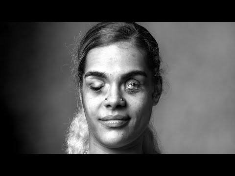 An Extreme Case of Domestic Violence-AK