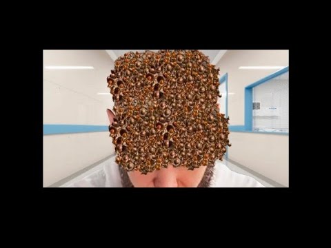 asmar remov all hid animation asmr dokthir 2d treatment, - YouTube