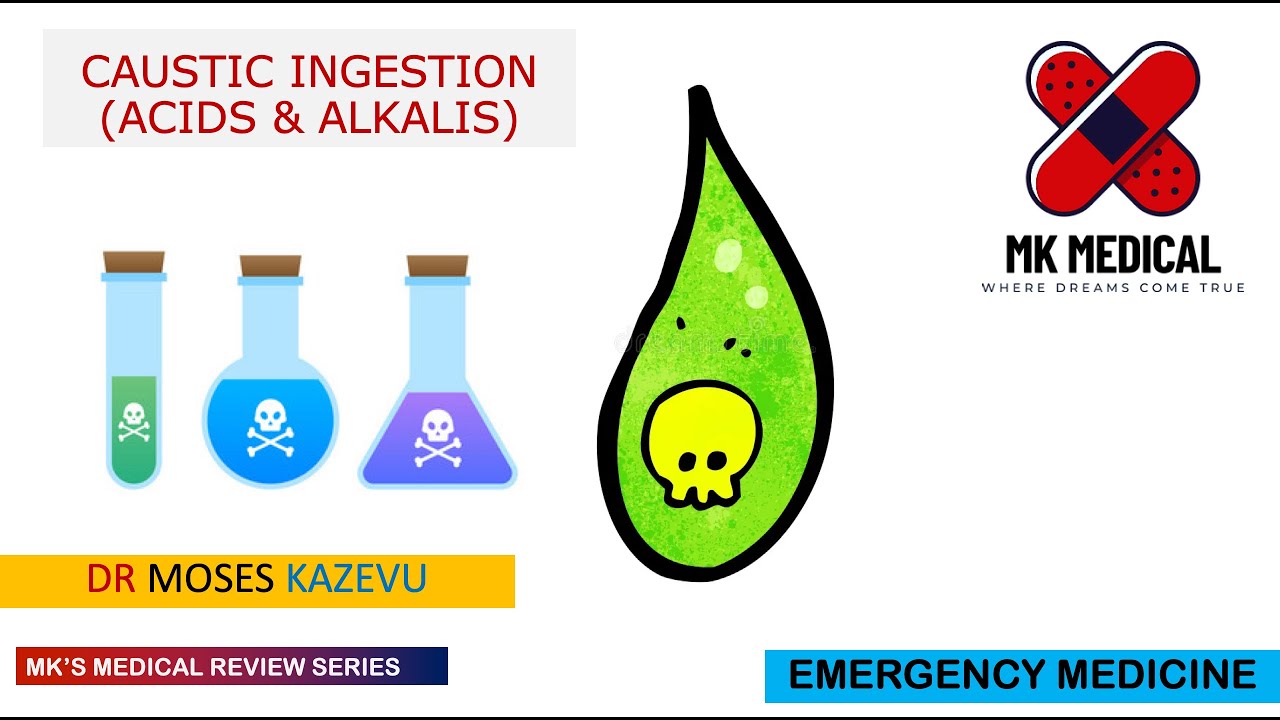 Caustic Ingestion (acids & alkalis) - YouTube