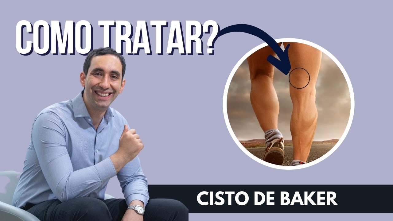Cisto de Baker ou Cisto Poplíteo: o que é? Qual o melhor Tratamento ...