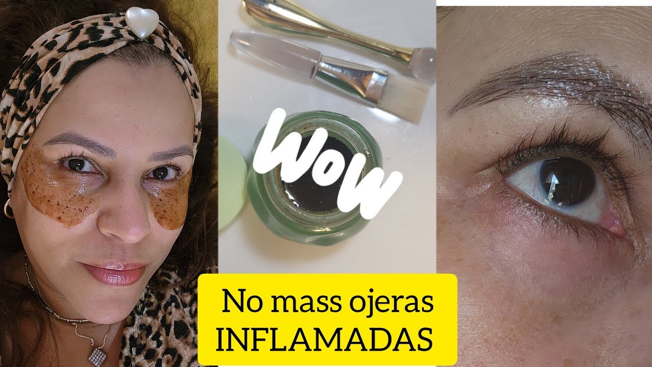 HAS ESTA PREPARACIÓN NATURAL CASERA ¿TE AYUDARÁ Con *LAS OJERAS ...